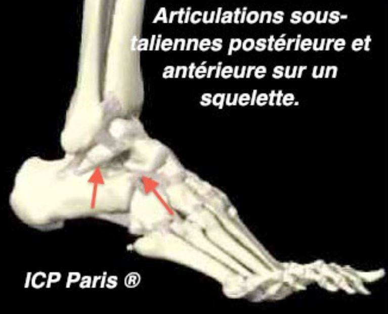 Opération & chirurgie du pied Paris 15ème - ICP Paris