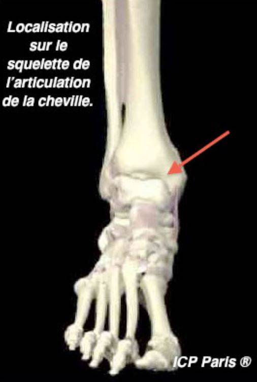 Opération & chirurgie du pied Paris 15ème - ICP Paris